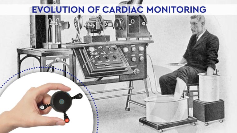 The Evolution of Cardiac Monitoring: From Wired Devices to Wireless ...