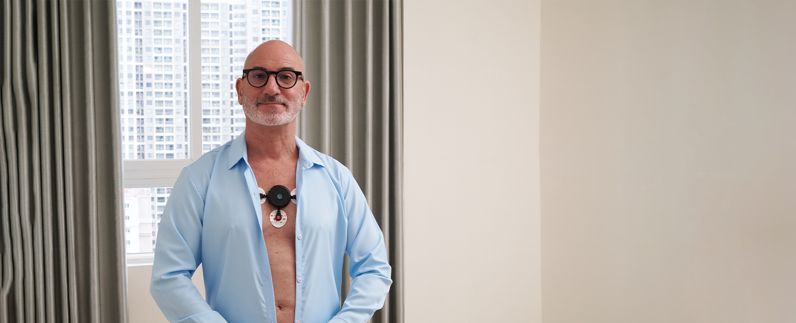 The Convenience and Accuracy of a Wireless 30-Day Heart Monitor ...